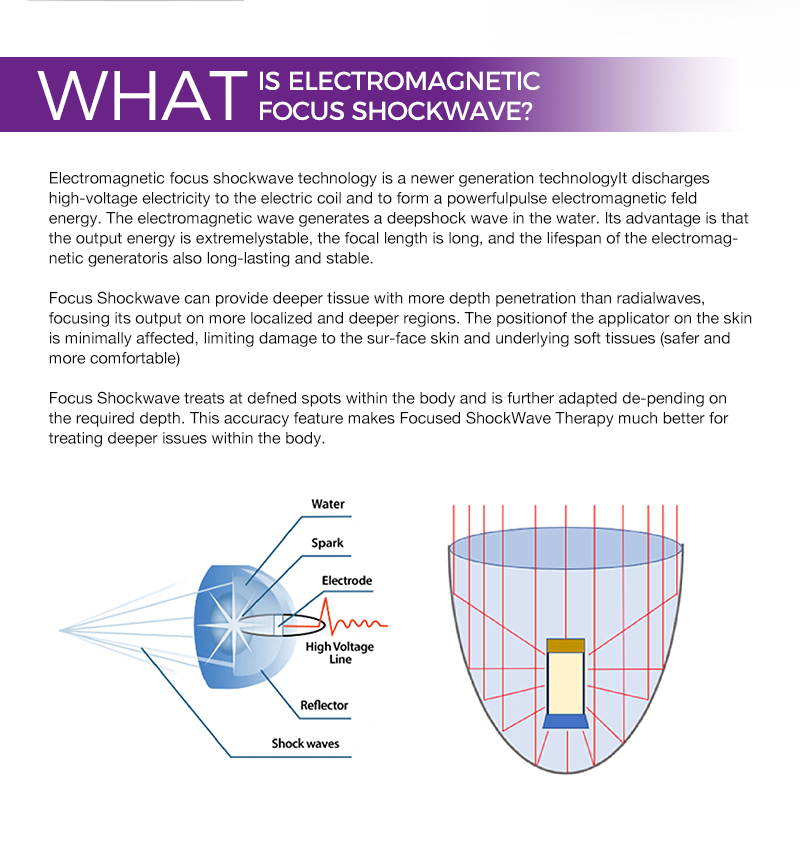Newangie® Focus Shockwave Machine - SW5 - Buy focus shockwave machine ...