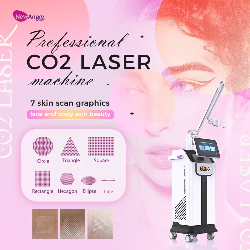 CO2 Lasers: A Popular Choice for Skin Whitening in Europe - Newangie ...