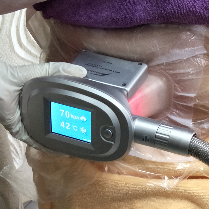 Fat Freeze Machines South Africa for Sale - Buy fat freeze machines ...